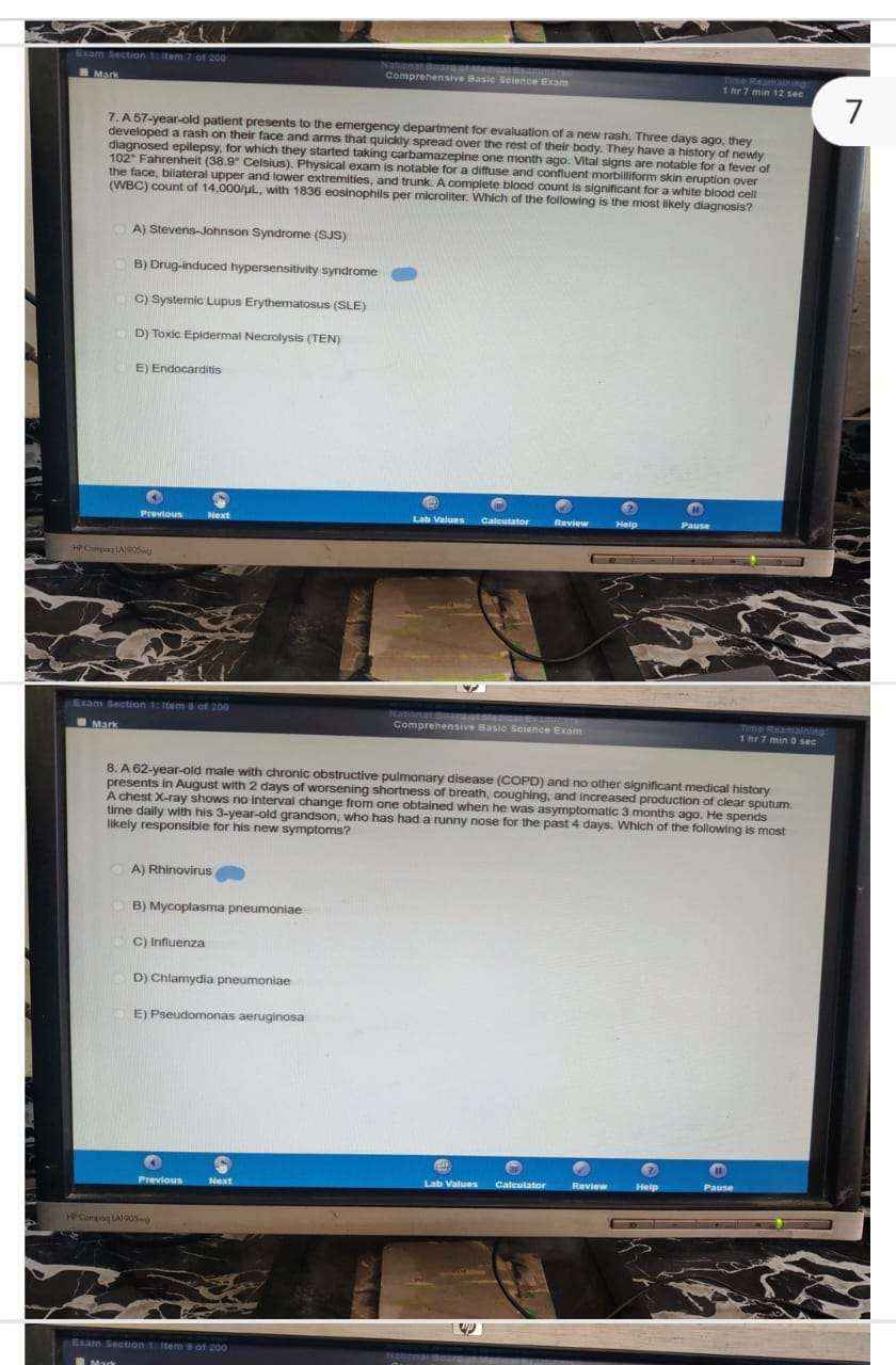 🧠 What is the CBSE Exam? A Complete Guide to Acing the NBME ...